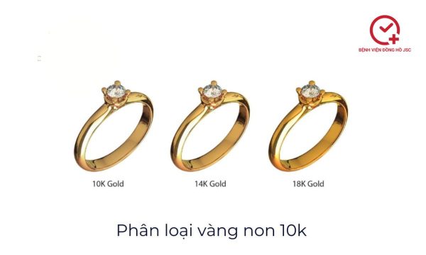 Vàng 10K là gì? Bán vàng 10K có được giá không?